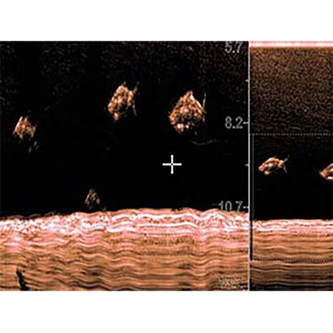 Raymarine Axiom Rv Promotional Pack Multifunction Display With Transducer And Med Chart Waveinn