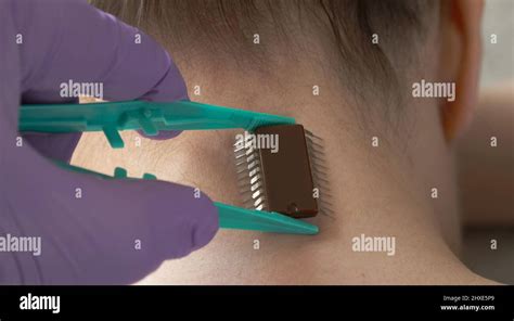 Implantation Of A Microchip Under Human Skin Human Mind Control Using Computer Technology