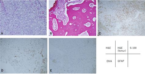 Various Types Of Physaliferous Cells Are Separated By Fibrous Septa In