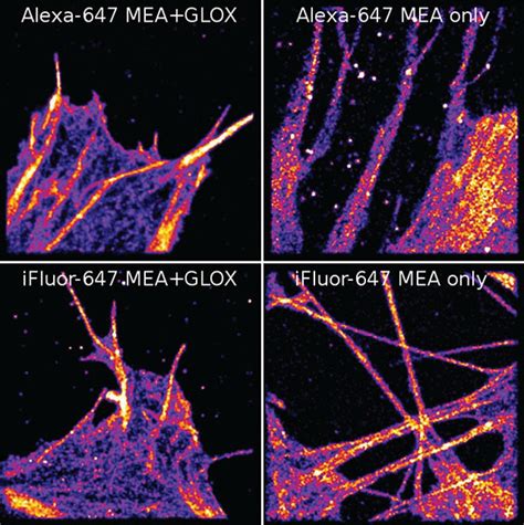 Correlative Atomic Force And Fluorescence Localisation Superresolution Microscopy For Imaging