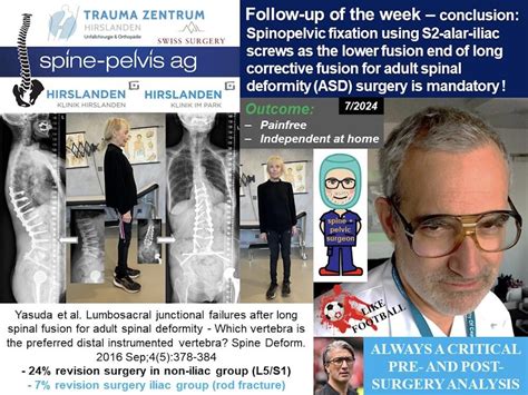 Follow Up Of The Week Spinopelvic Fixation Reduces The Risk Of