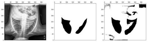 Examples Of Lung Segmentation In Cxr Images From The Jms Validation Download Scientific Diagram