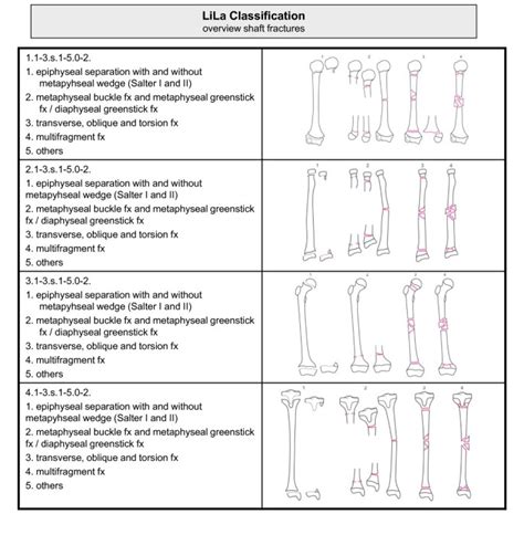 Development And Validation Of A Paediatric Long Bone Fracture Classification A Prospective