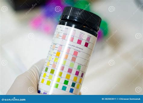 Urine Strip With Scientist In Lab Stock Image Image Of Hospital Bottle 282003811