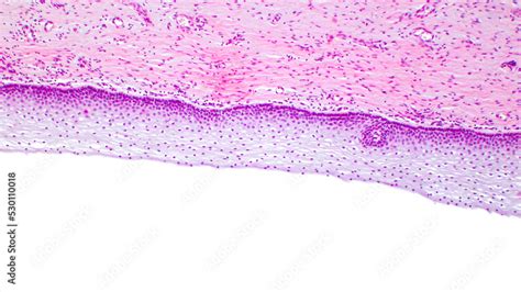 Vaginal Epithelium Non Keratinized Stratified Squamous Epithelium Of The Vagina Light