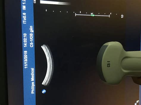 Broadband Curved Array Transducer Probe C5 1 For Philips Ultrasound Iu22 Buy C5 1c5 1 Probe