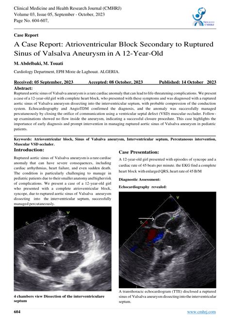 Pdf A Case Report Atrioventricular Block Secondary To Ruptured Sinus Of Valsalva Aneurysm In