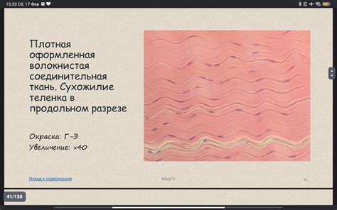 Создать мем плотная оформленная соединительная ткань препарат продольный срез плотная