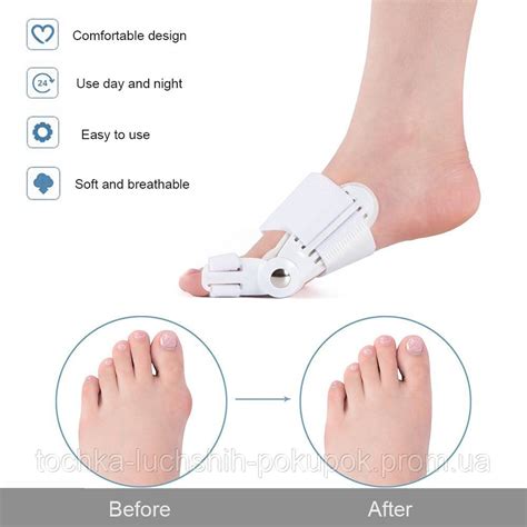 Вальгусная шина "Bunion aid YH-06" Белая, бандаж на большой палец ноги ...