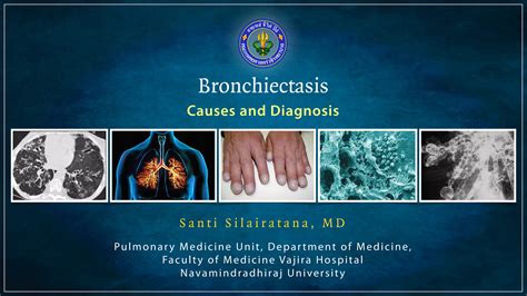 Bronchiectasis Causes And Diagnosis Pdf