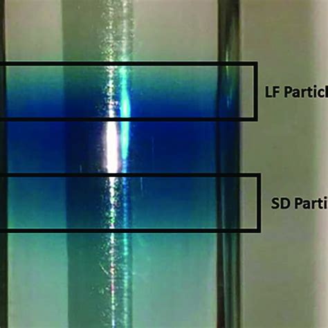 The Selection Process Schematic Lf Ldl Sd Ldl And Hdl Refer To Light