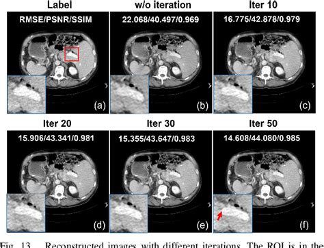 figure 13 from iterative residual optimization network for limited
