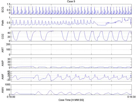 Case Waveform Plots Second Plots