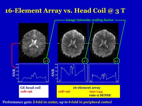 PPT Receive Coil Arrays And Parallel Imaging For FMRI Of The Human Brain PowerPoint