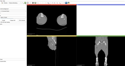 volume rendering does not appear support 3d slicer community