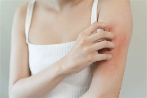 Pimples Rashes Like Pimples Or Hives And The Reason For Their Appearance Symptom