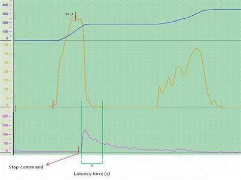Stop Test Con Emg Medici Oggi