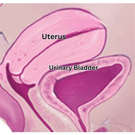 PCOS Pelvic Inflammatory Disease PID