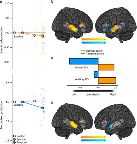 Speech Production With Binaurally Presented Spectral And Temporal Download Scientific Diagram