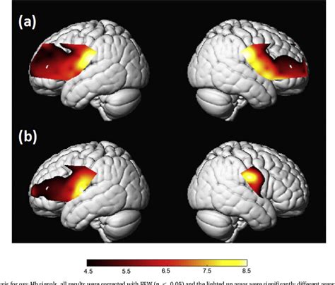 Figure 1 From Decreased Prefrontal Brain Activation During Verbal Fluency Task In Patients With