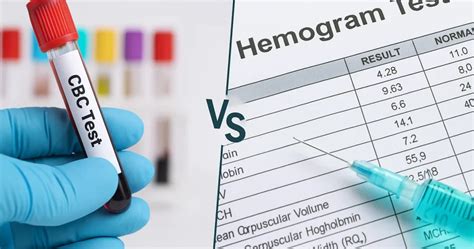 What Is Cbc And Hemogram Test Know Major Differences