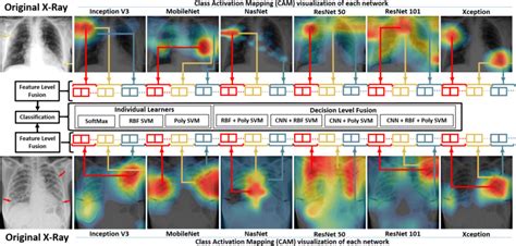 Cam Visualizations Of Two Patients Obtained By Six Cnns Top And Bottom
