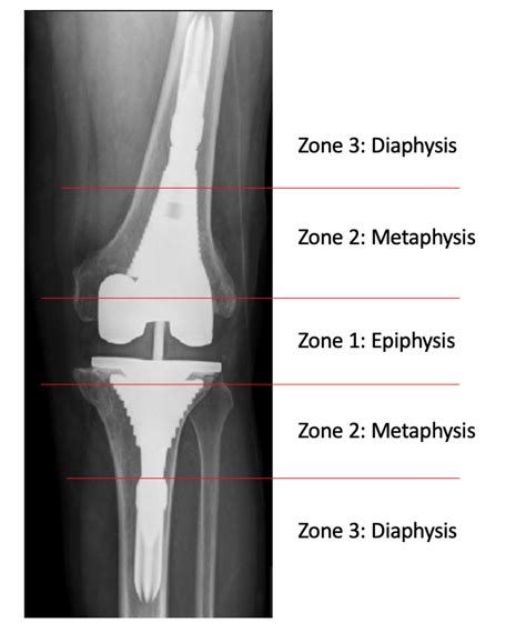 Zonal Classification Download Scientific Diagram