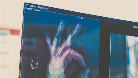 Unlocking Ai Inference Horizons With Oracle Cloud And Nvidia Triton Elnion