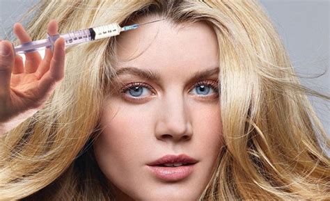Botox Scalp Sweating I Woodruff Institute For Dermatology
