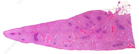 Spleen Light Micrograph Stock Image C051 7230 Science Photo Library