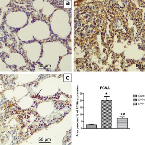 Photomicrographs Of Pcna Immunohistochemical Staining Of Rat Lung