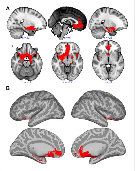 Functional Connectivity Common To All Subregions A Brain Regions