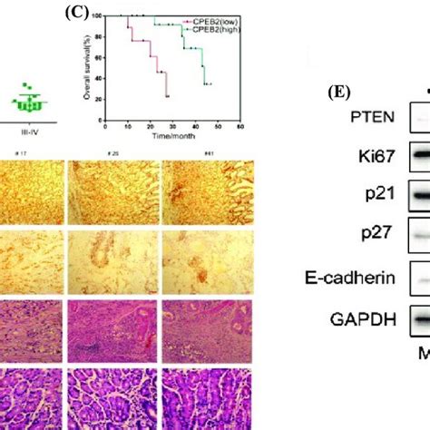 A Expression Of Cpeb2 Mrna In Gc Tissues And Adjacent Normal Tissues