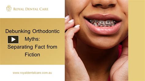 PPT Debunking Orthodontic Myths Separating Fact From Fiction PowerPoint Presentation Free