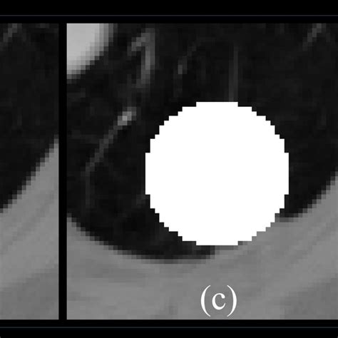 Lung Nodule Simulation Using The 3d Cgan A A Voi Centered At A Lung Download Scientific