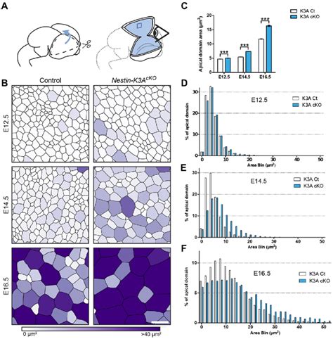 Cilia Abrogation Leads To The Progressive Enlargement Of Rgc Apical