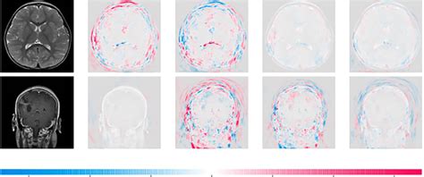 Shap Plots Visualizing Neural Network Identification Of A Normal Brain