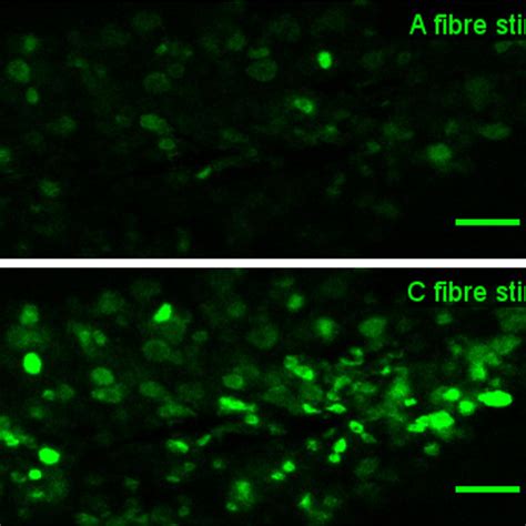 Pdf Large Scale In Vivo Recording Of Sensory Neuron Activity With Gcamp6