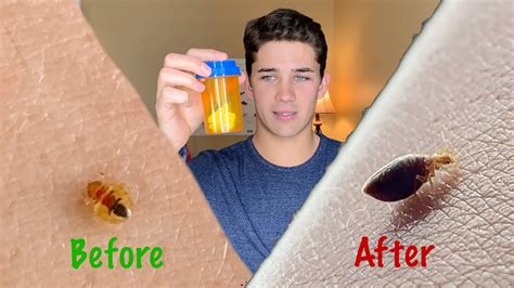 How Long Does It Take To See Bed Bugs After Being Exposed At Dominic Chumleigh Blog