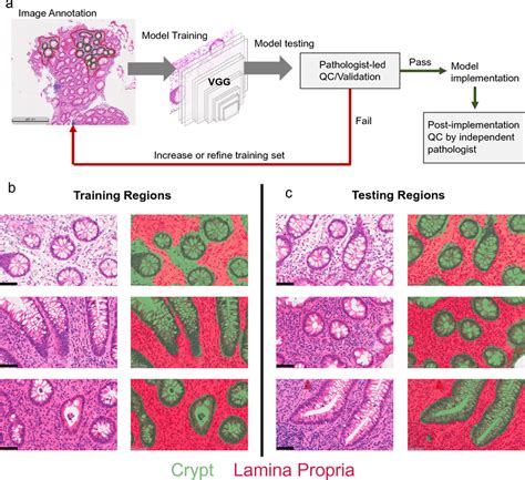 Development Of An Aiml Algorithm For Uc Tissue Segmentation A The