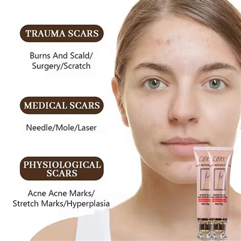 Lifitt 成人抗妊娠纹霜精华修复霜用于妊娠纹去除痤疮疤痕直接制造商产品 购买痤疮疤痕去除妊娠纹 疤痕去除霜 护肤品 制造商 Skin