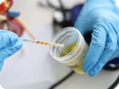 Drug And Alcohol Testing Prohms