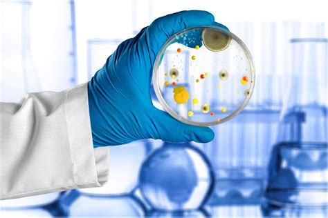 Common Causes Of Foodborne Illness Brockman Law Firm