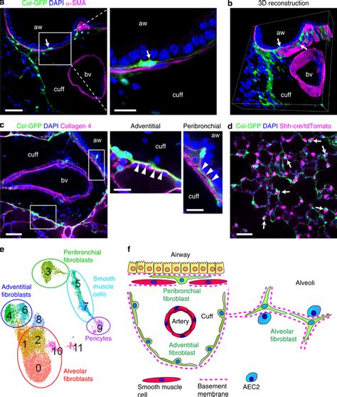 Characterization Of Alveolar Adventitial And Peribronchial Download Scientific Diagram