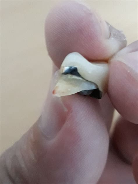 시발 치실쓰다가 이빨빼버렸는데 이거 어카냐 포텐 터짐 최신순 에펨코리아