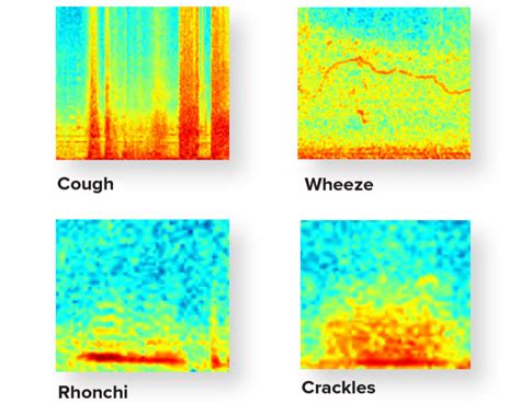 Wheeze Monitor And Asthma Wearable Device Resp® Biosensor