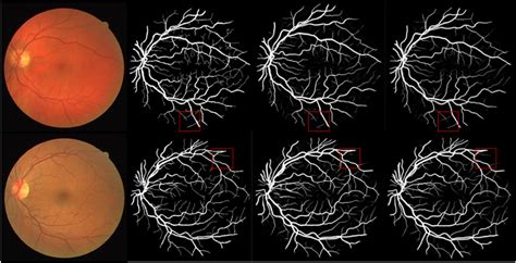 A Drive Original Image B Gold Standard C Unet Segmentation Result D Download Scientific Diagram