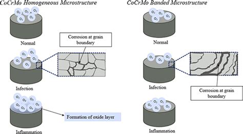 Microstructure Matters Corrosion Vulnerability Of Cocrmo Alloys In Simulated Biological