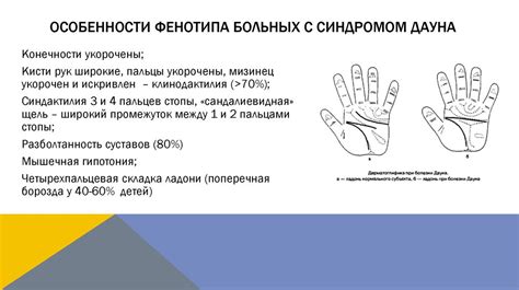 Особенности ранней логопедической помощи детям с синдромом Дауна презентация онлайн