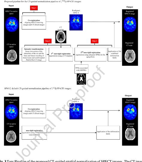 figure 1 from ct guided spatial normalization of nuclear hybrid imaging